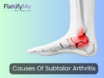 Subtalar Arthritis: Causes, Symptoms, Treatment, Physiotherapy & More