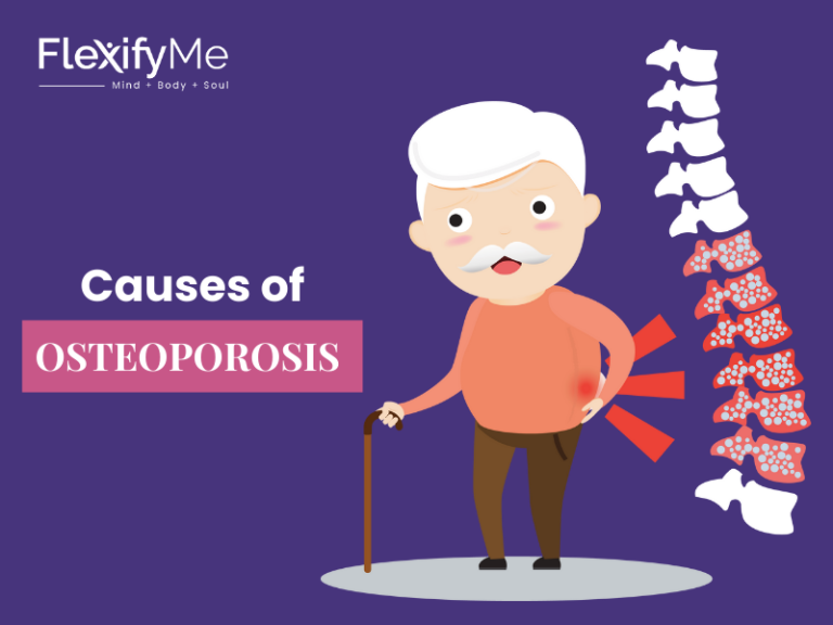 Osteoporosis Causes Symptoms And Effective Treatment Options
