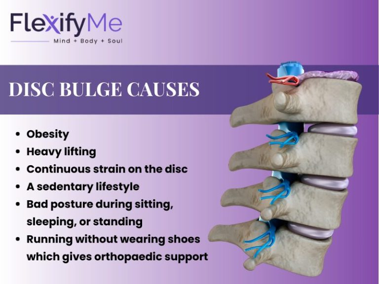 Bulging Disc: what Is It, Symptoms, Causes, Treatment Options