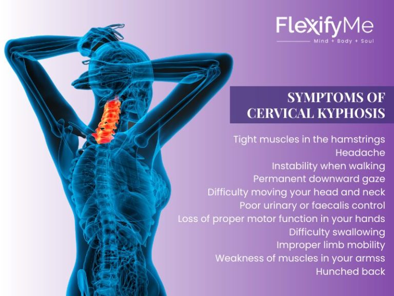 Cervical Kyphosis: Causes, Symptoms, 6 Effective Exercises and More