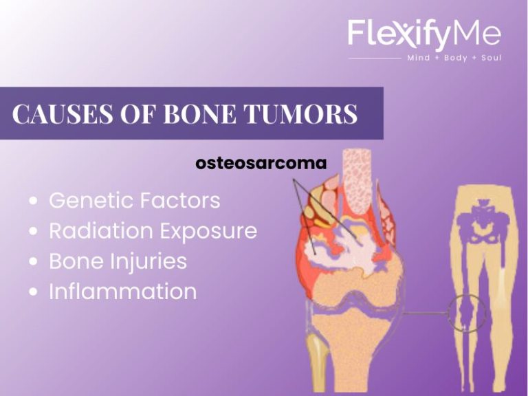 Bone Tumors: Classification, Causes, Symptoms, & Treatments