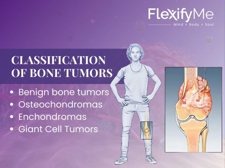 Bone Tumors: Classification, Causes, Symptoms, & Treatments