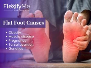 Flat Foot: Symptoms, Exercises, Diagnosis, and Treatment