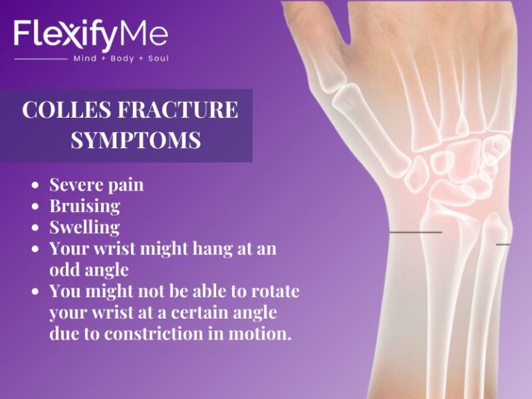 Understanding Colles Fracture: Symptoms to Solutions