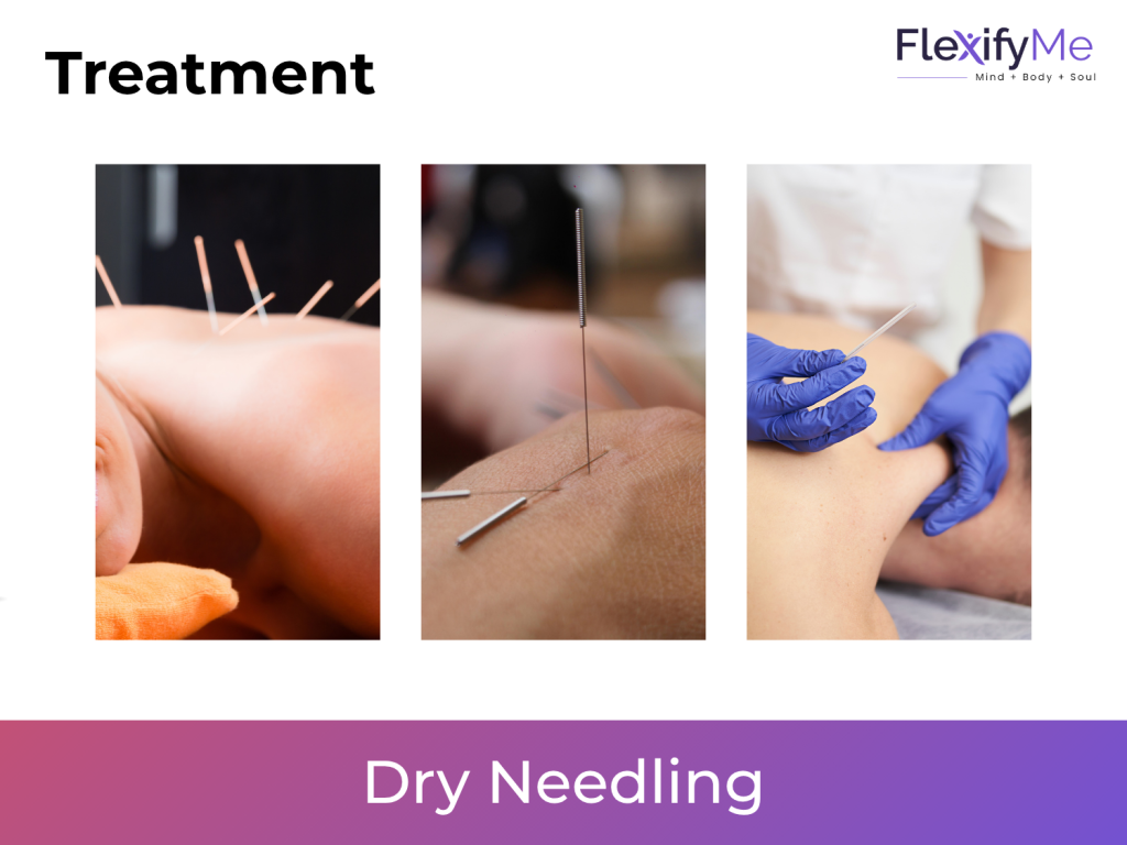 A Guide To 7 Best Stretches for Plantar Fasciitis Relief